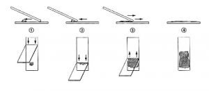 Mastering your blood smear technique - NABSnet